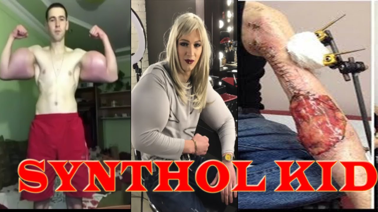 Freak synthol Kid arm infection - YouTube