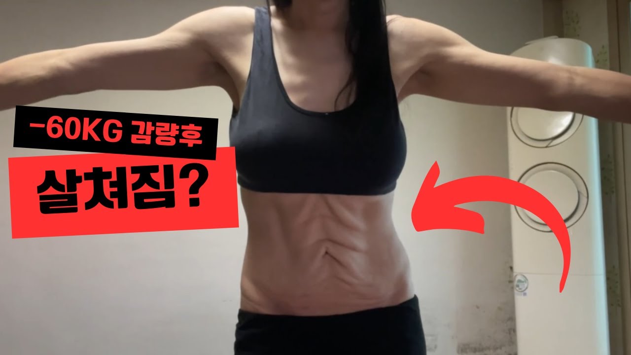 - 60KG 다이어트 감량후 폭풍 살 쳐짐?! - YouTube