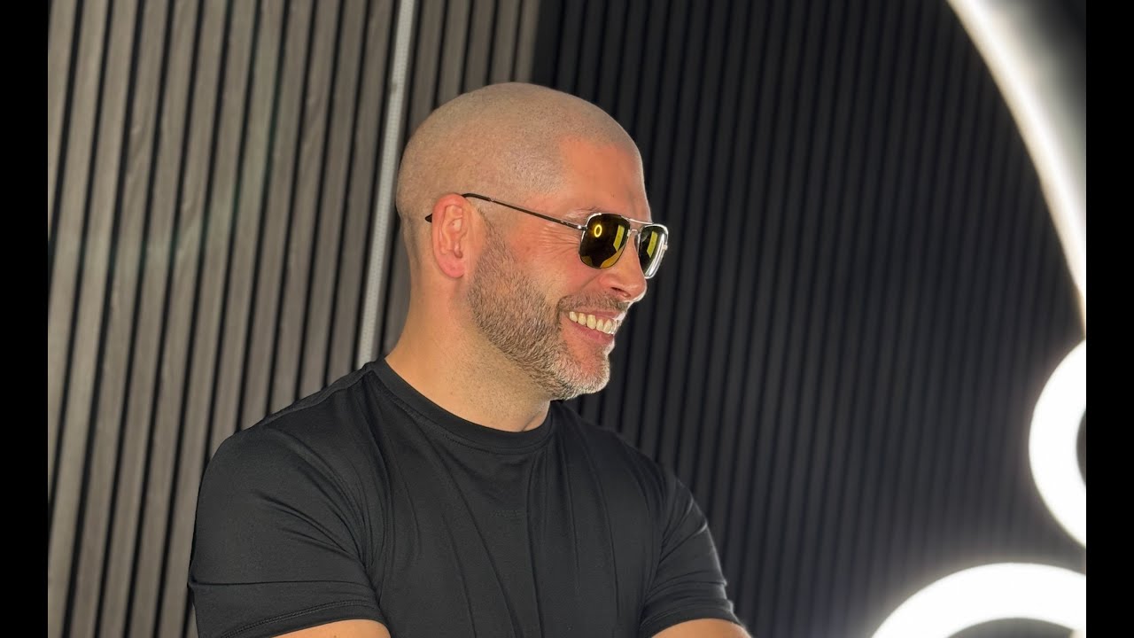 "I Finally Did It – My Scalp Micropigmentation Journey | Real Client ...