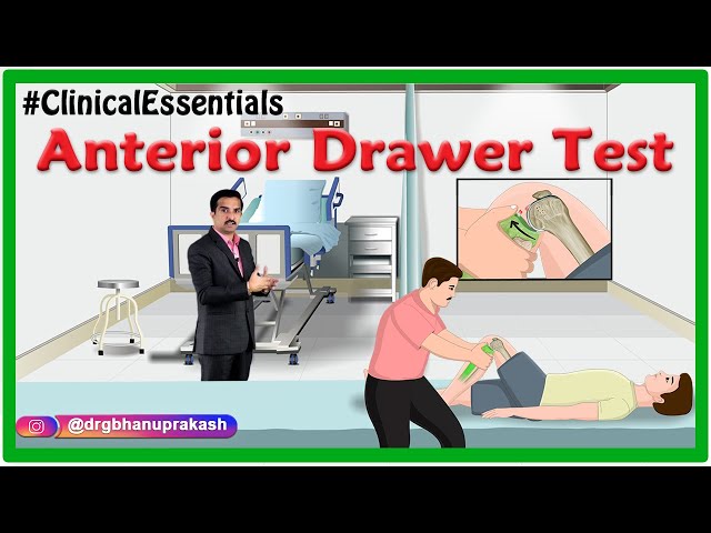 Anterior Drawer Test