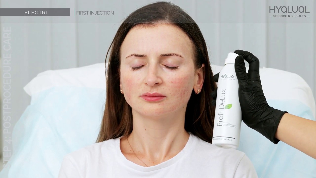 ELECTRI – FIRST INJECTION - YouTube