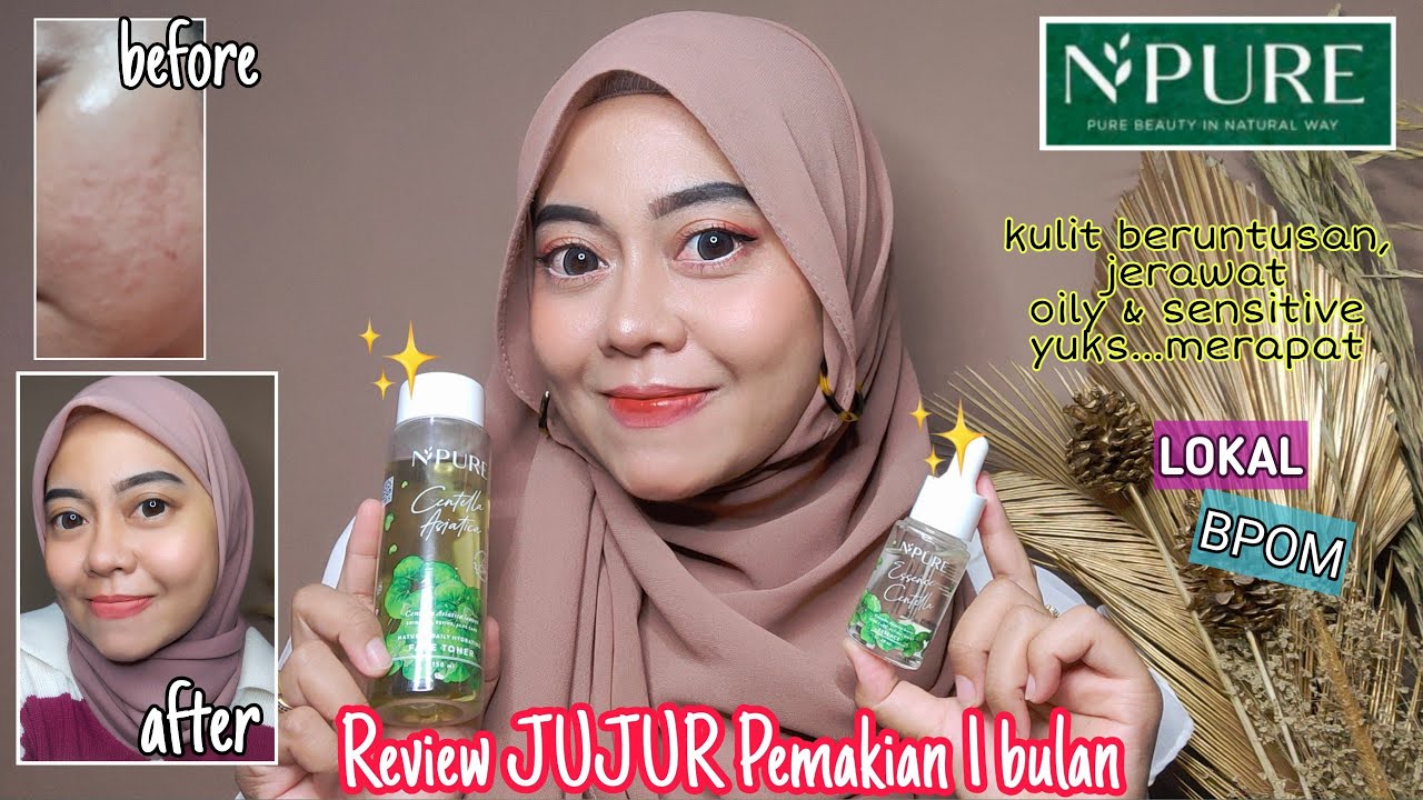 N'Pure Toner + Essence Centella Asiatica REVIEW || Acne Care Cica ...