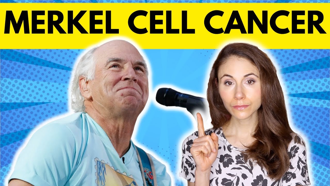 Merkel Cell SKIN CANCER EARLY SIGNS NOT TO MISS - YouTube