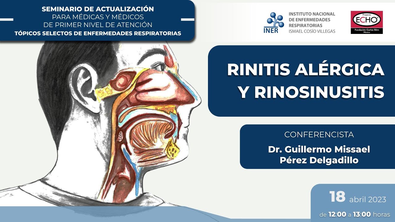 Seminario ECHO - INER: RINITIS ALÉRGICA Y RINOSINUSITIS - YouTube
