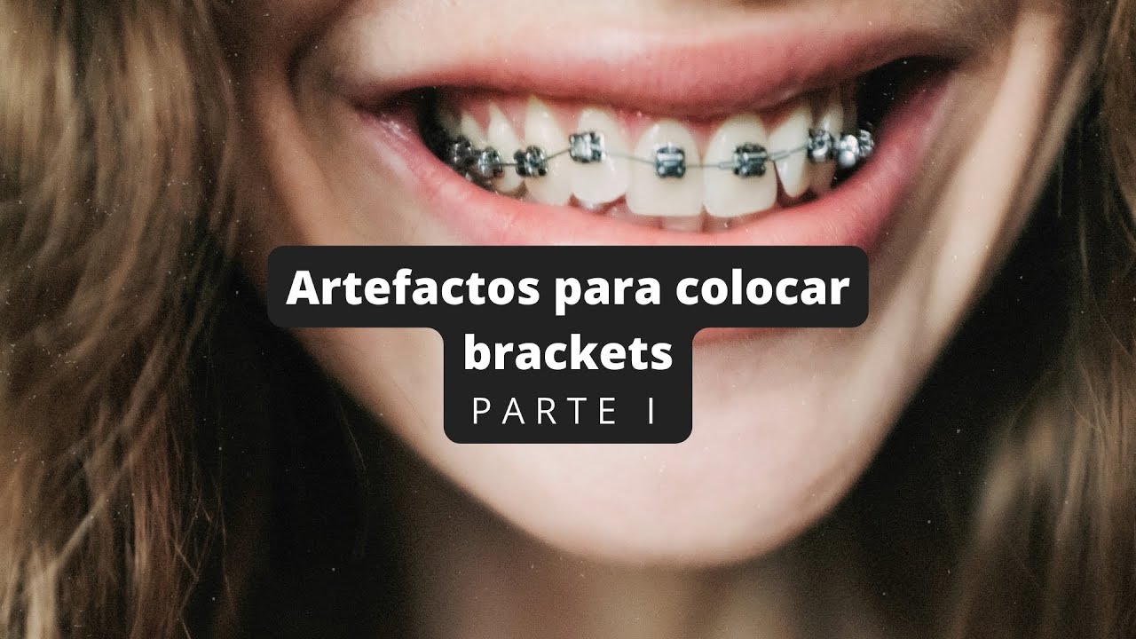 Así colocamos tus brackets! Parte I - YouTube