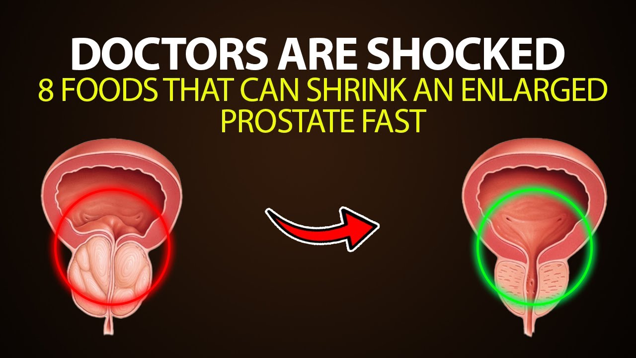 Discover the 8 foods That Can Shrink an Enlarged Prostate Fast and ...