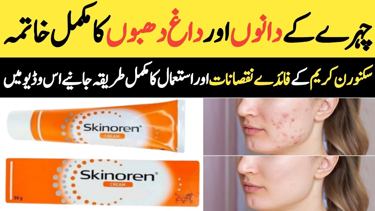 Skinoren Cream Uses and Side Effects | Skinoren Cream How To Use ...