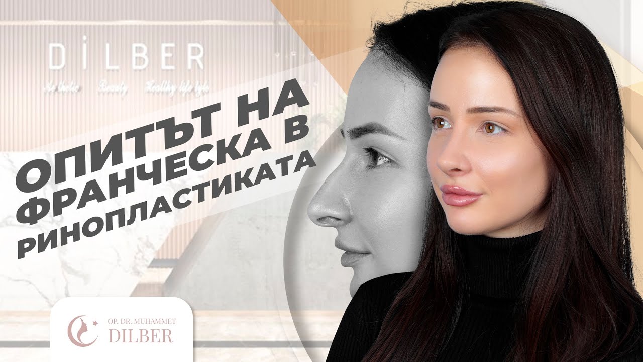 Едномесечното преживяване на Франческа преди и след ринопластика Youtube