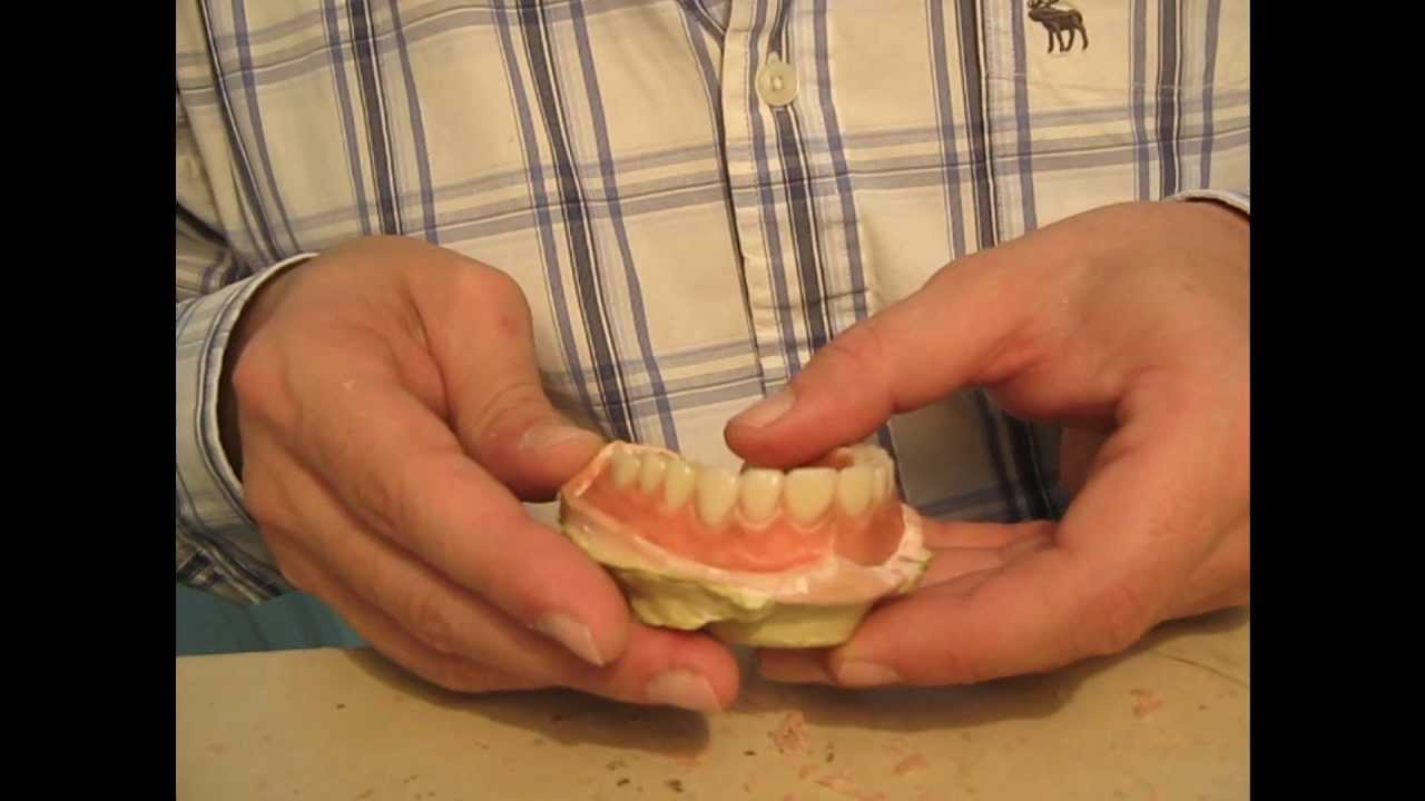 festoneado de una prótesis total - YouTube