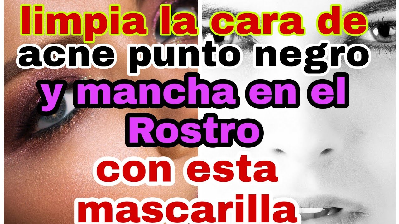 como LIMPIAR la cara de ACNE punto negro y MANCHA en el Rostro - YouTube