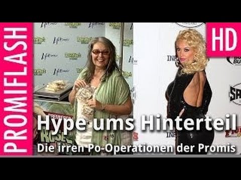 Popo-Perfektion: Promis schnippeln sich die Hintern prall