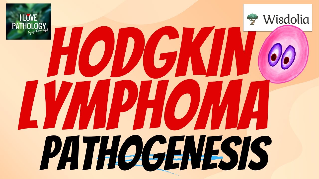 HODGKIN LYMPHOMA | PATHOGENESIS | Reed-Sternberg Cell - YouTube