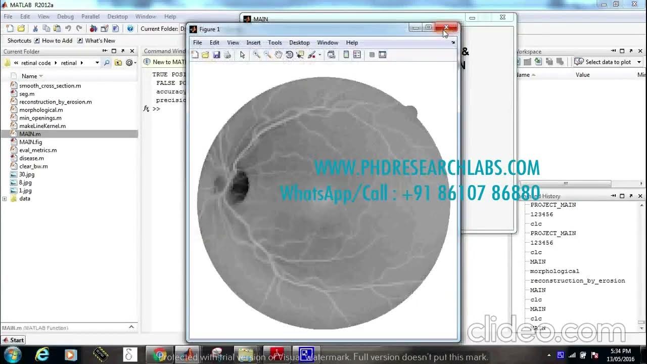 ANALYSIS OF RETINAL BLOOD VESSELS USING IMAGE PROCESSING TECHNIQUES #matlab - YouTube
