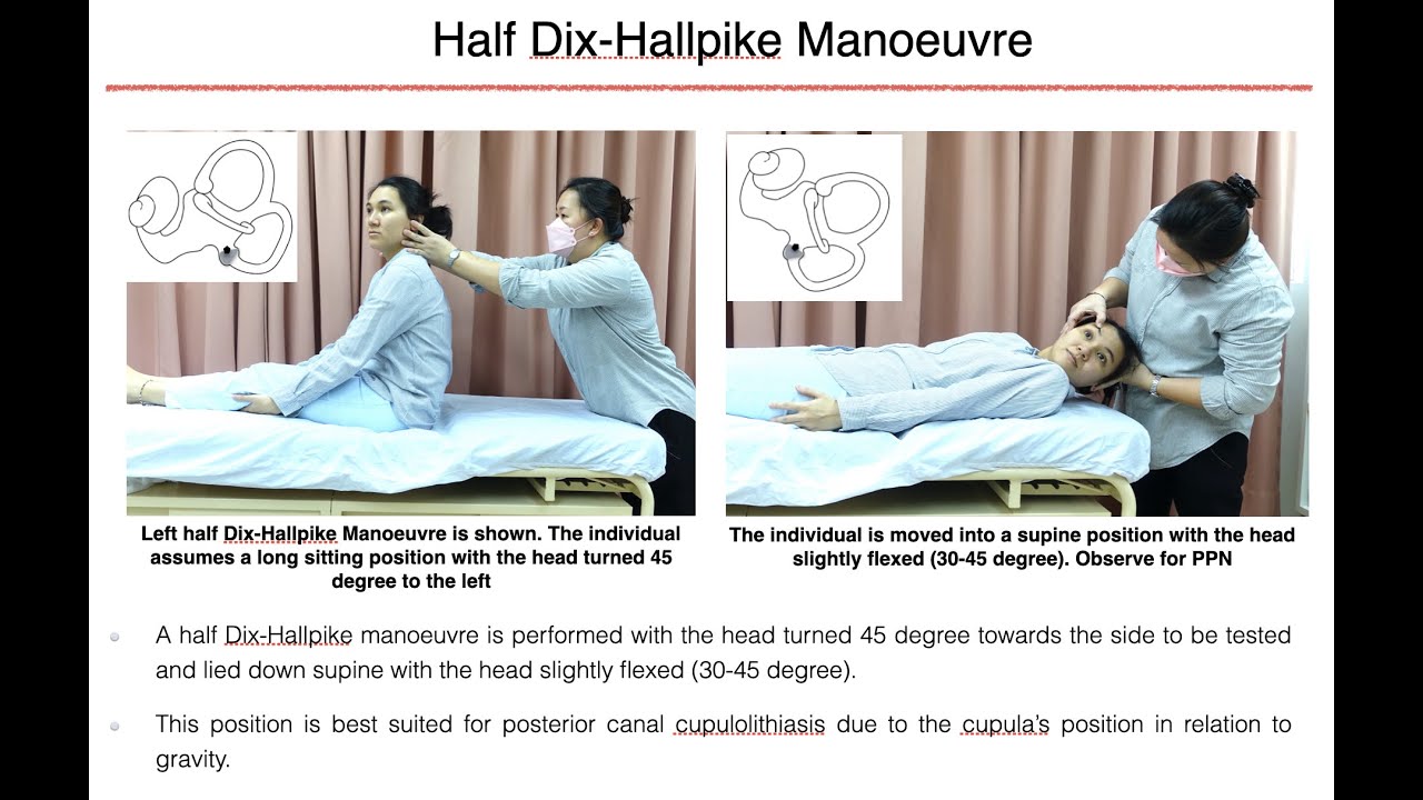 Half Dix-Hallpike Manoeuvre - YouTube