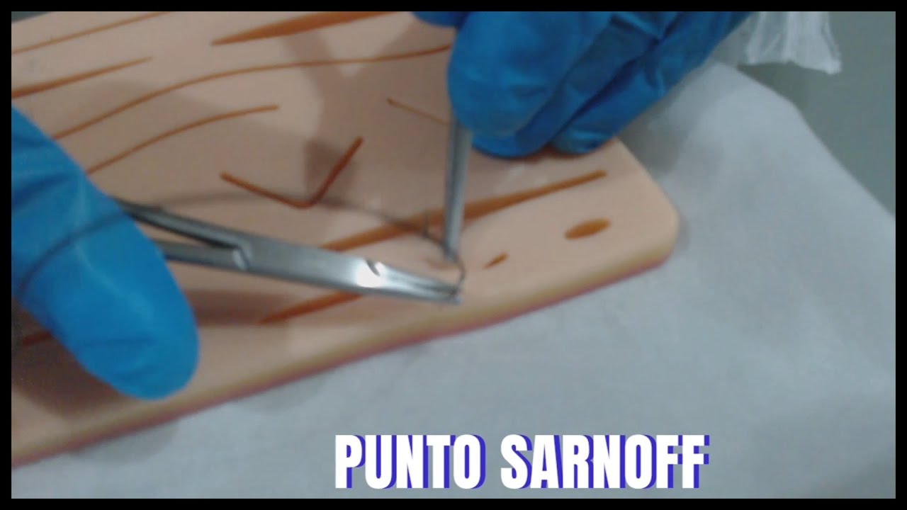 Punto Sarnoff - YouTube