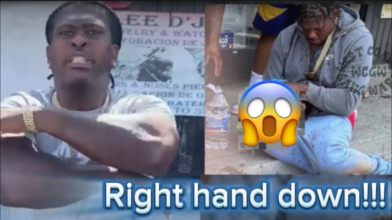 4xtra blew his hand off with a firework - YouTube