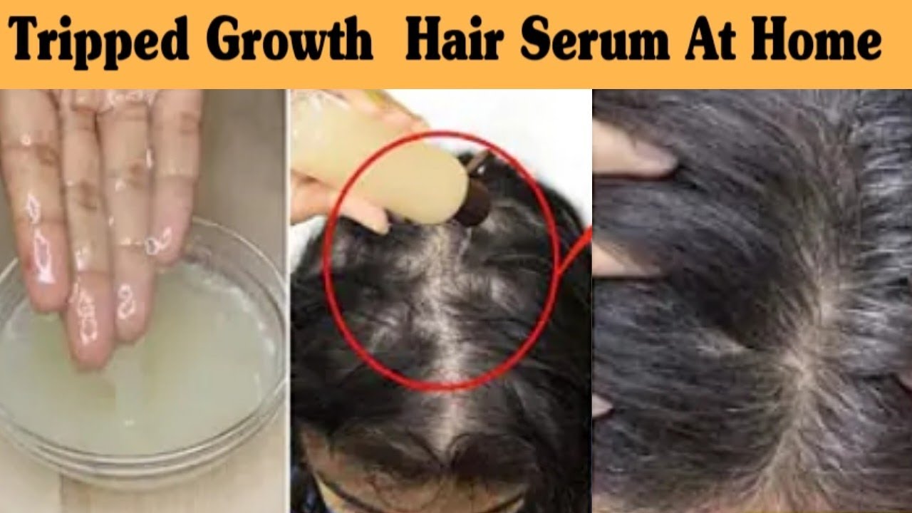 Triple Hair Growth Boosting Gel-Grows back hair even in bald head ...