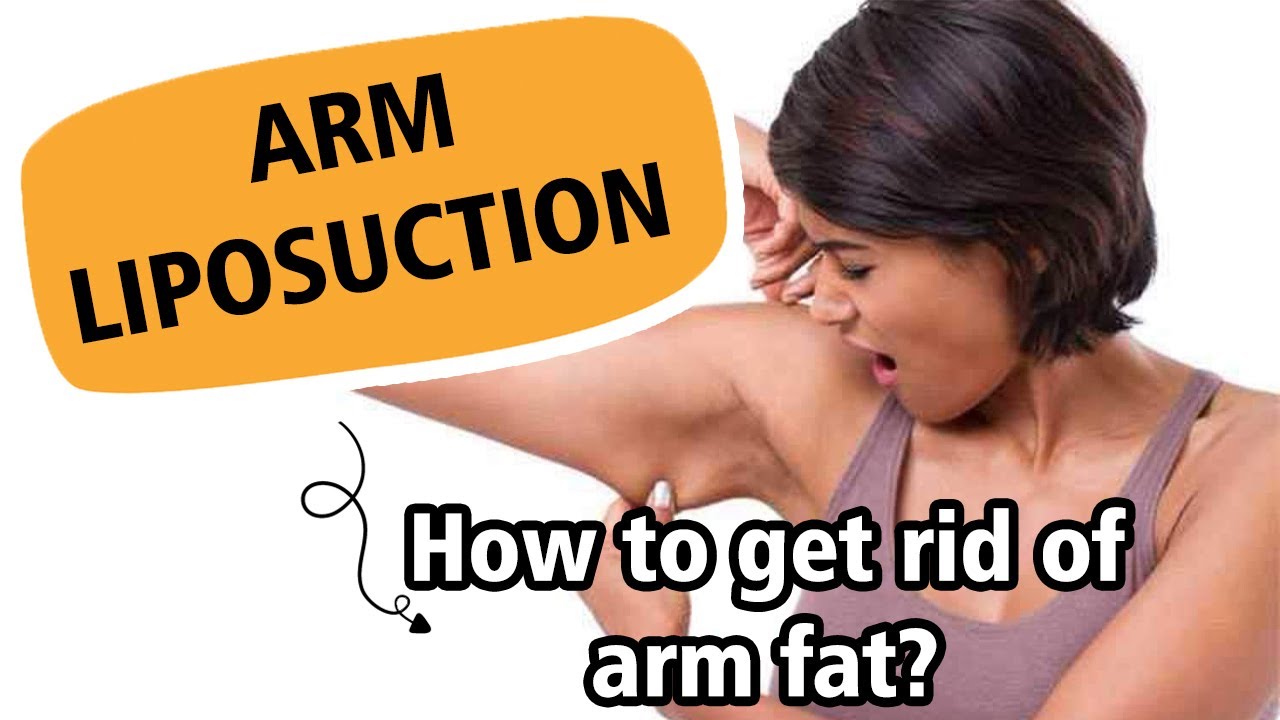 ARM LIPOSUCTION PROCEDURE AND RECOVERY | GET RID OF YOUR ARM FAT ...
