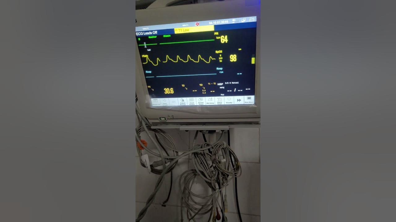 Spot light spo2 - YouTube