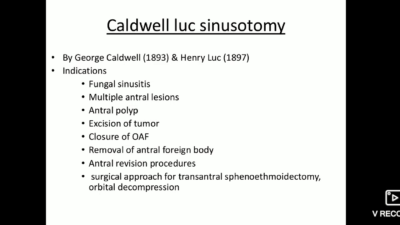 Caldwell Luc procedure - YouTube