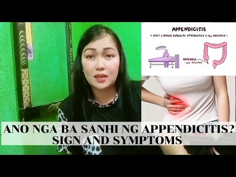 MGA SINTOMAS NG APPENDICITIS /APPENDIX (ano nga ba ang sanhi ng ...