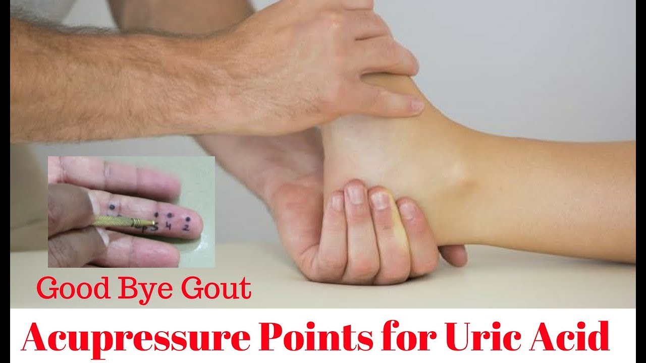 How to Control Uric Acid by Sujok Acupressure - YouTube