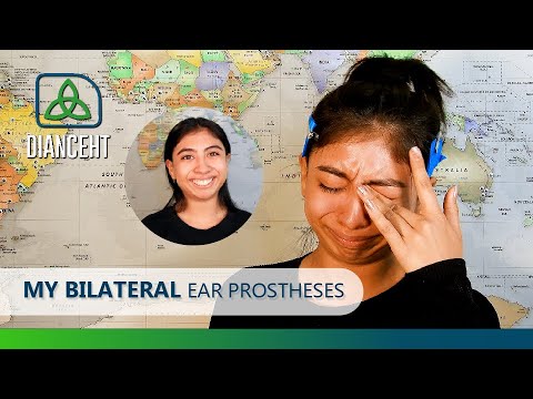 BILATERAL EAR Prostheses | Prótesis Bilateral de DIANCEHT No. 281 - YouTube