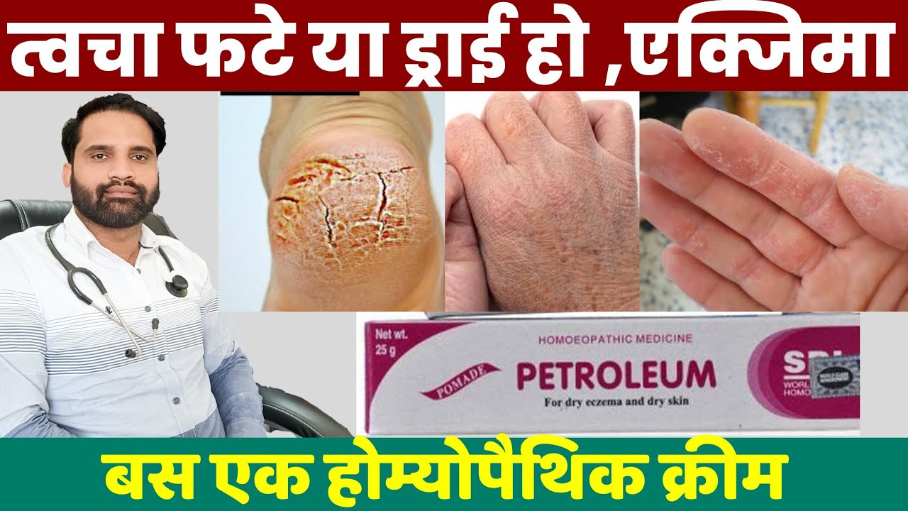 Petroleum ointment homeopathic uses | Sbl petroleum cream uses in hindi ...