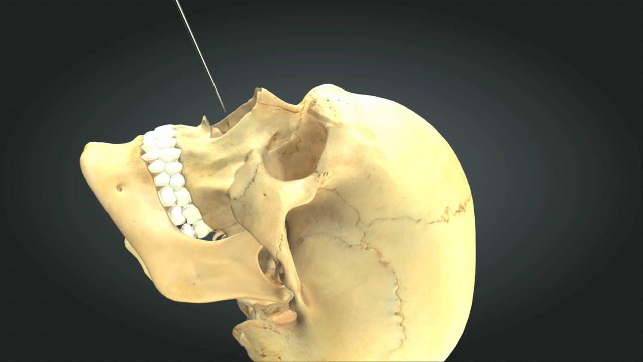 MultiGuide - Transnasal injection - YouTube