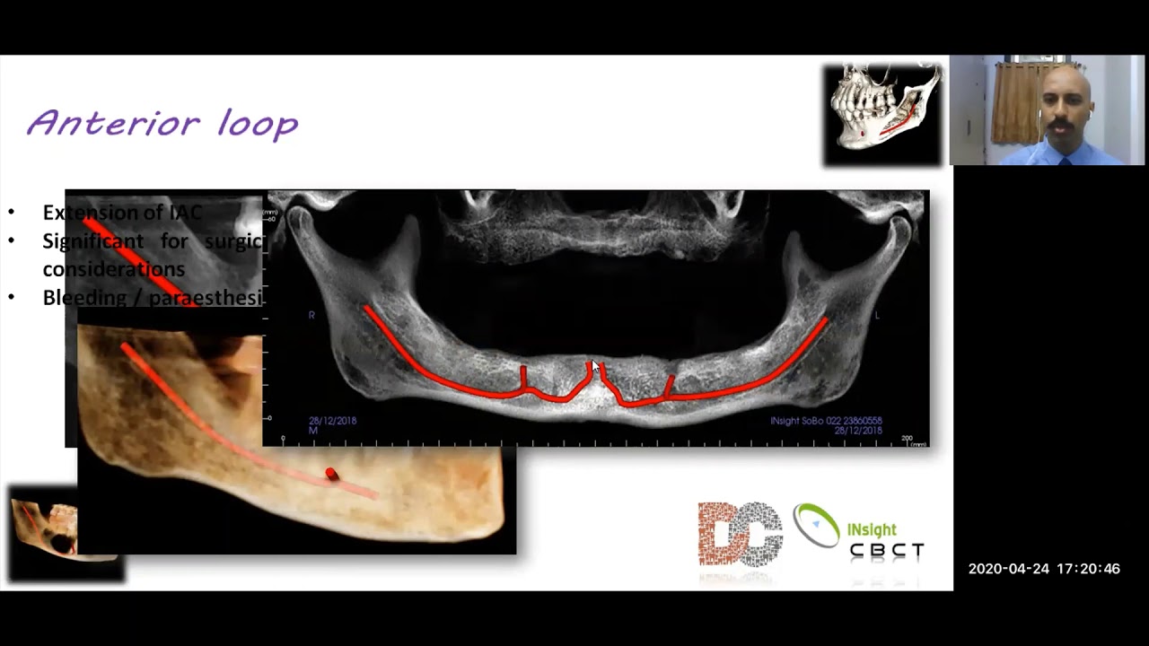 Clinical Applications of CBCT – An Overview ll Webinar 1 ll DC Academia ...