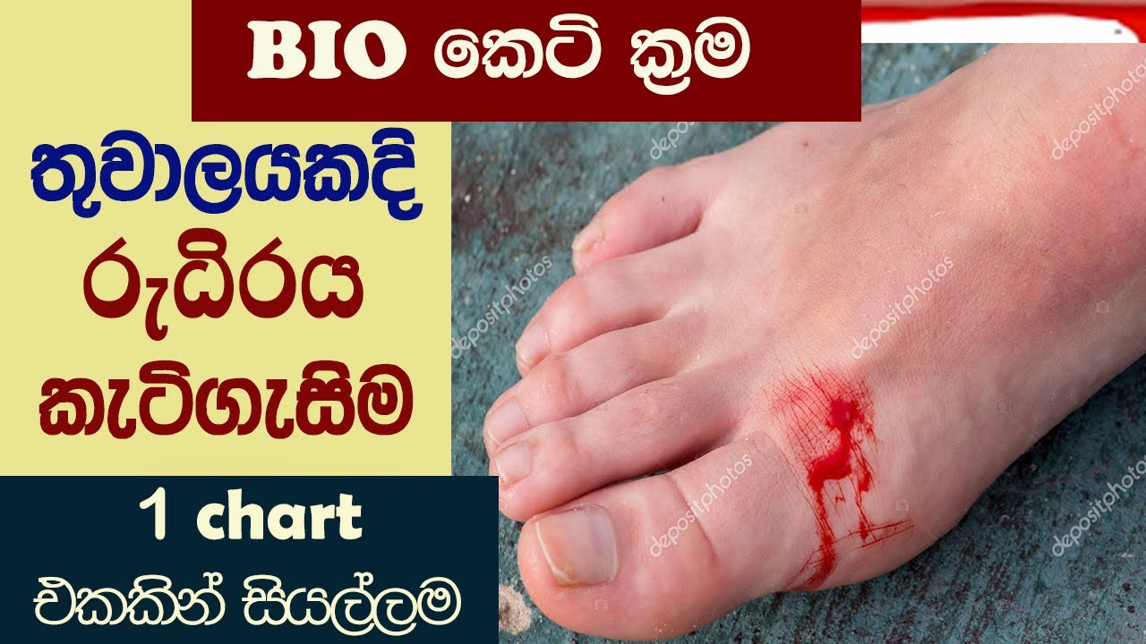 රුධිරය කැටි -blood cloting | A/L Biology - YouTube