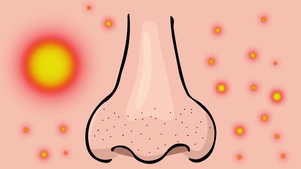 Face Cleaning, Makeover ASMR Animated (pimples) - YouTube