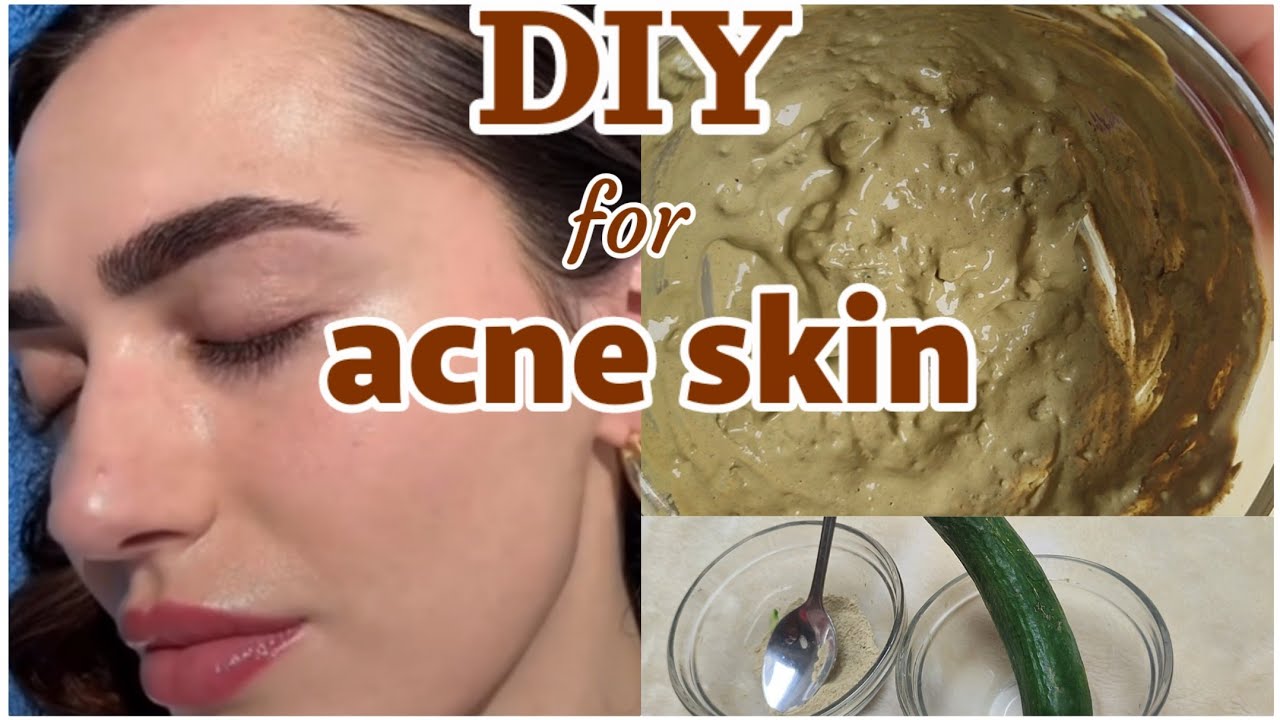 DIY | clearer fresher and glowing skin face pack | best for acne and ...