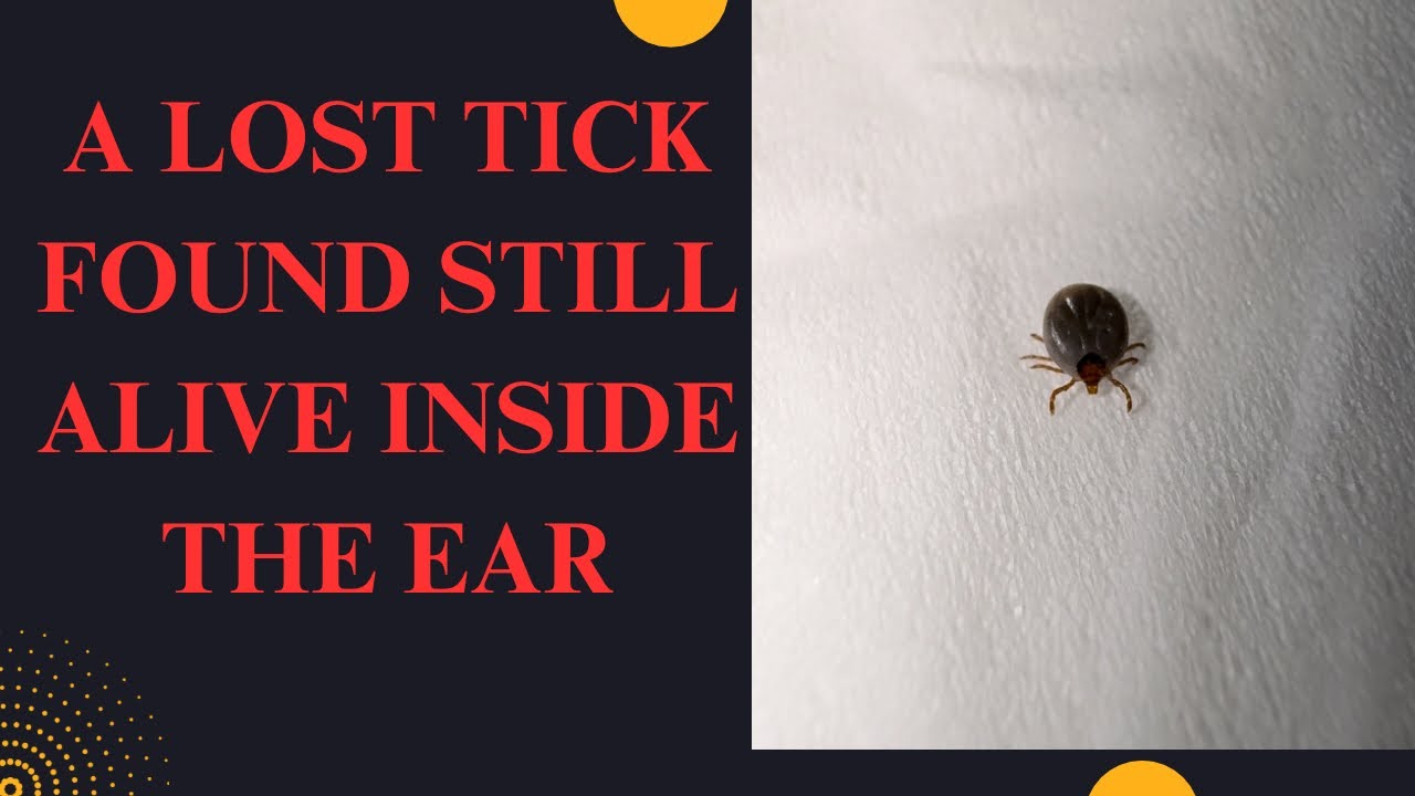 A Lost Tick Found Still ALIVE Inside The Ear !!! - YouTube
