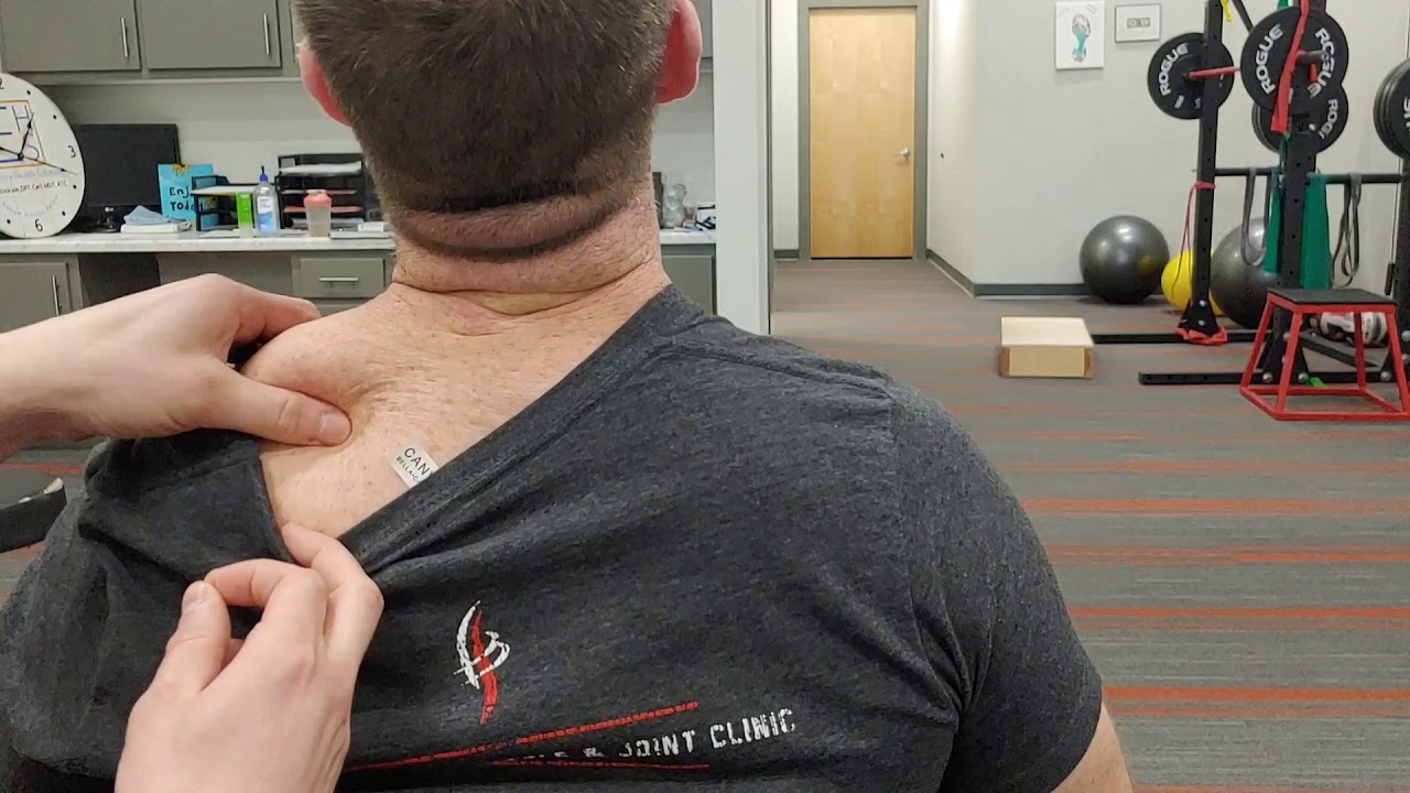 I get dry needled with electric stimulation for the first time! - YouTube