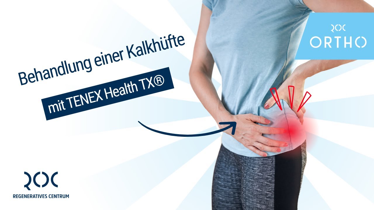 Behandlung einer Kalkhüfte mit TENEX Health TX® - ROC in Aschheim - YouTube