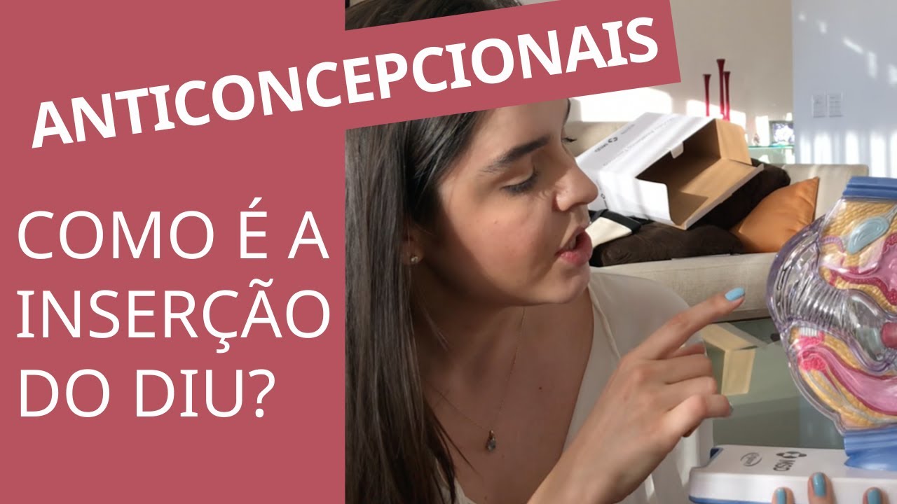 Como é a inserção do DIU? Dói para colocar DIU? DIU de cobre como ...