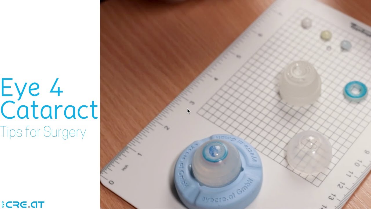 Eye 4 Cataract, Tips for Surgery - YouTube