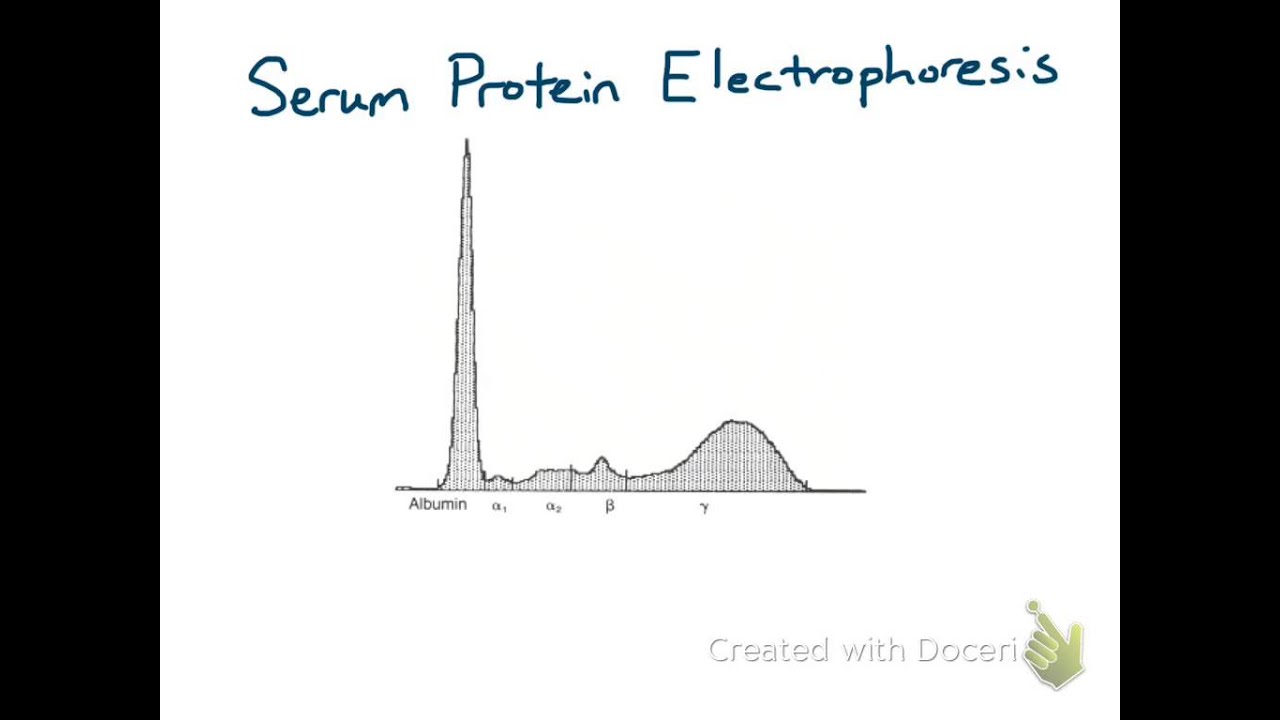 Hyperproteinemia - YouTube