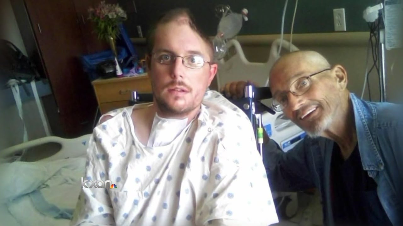 Man still recovering after being hit by rock driving down I-35 - YouTube