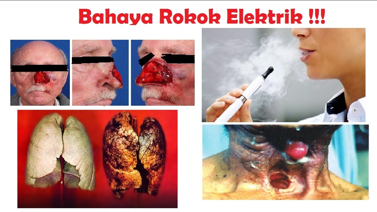 Bahaya dan Dampak rokok elektrik (Vapor) bagi tubuh manusia ! - YouTube