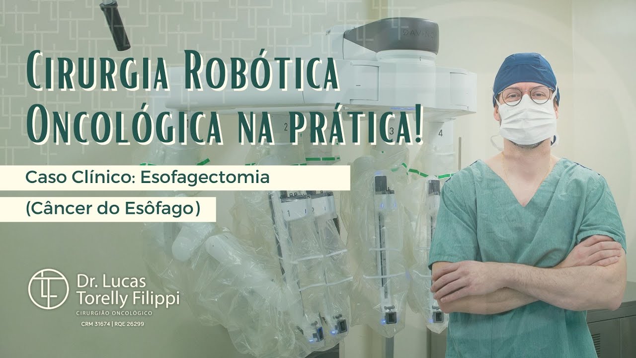 Cirurgia Robótica Oncológica - Esofagectomia (Câncer de Esôfago) - YouTube