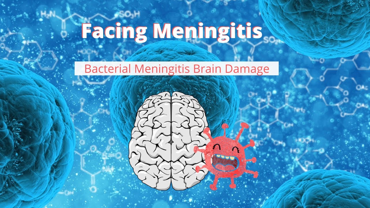 Bacterial Meningitis Brain Damage - What Is Meningitis? | Signs ...