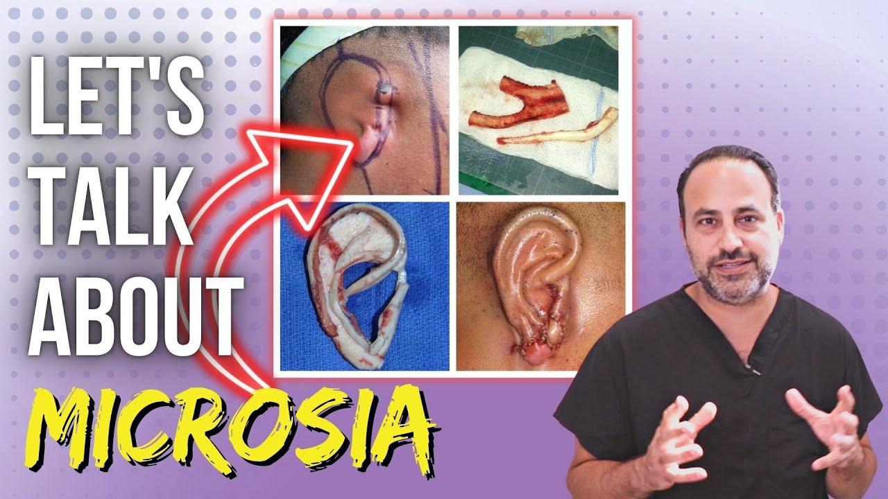 Microtia Treatment Insights: Empowering Lives | Lesson of the Day - YouTube