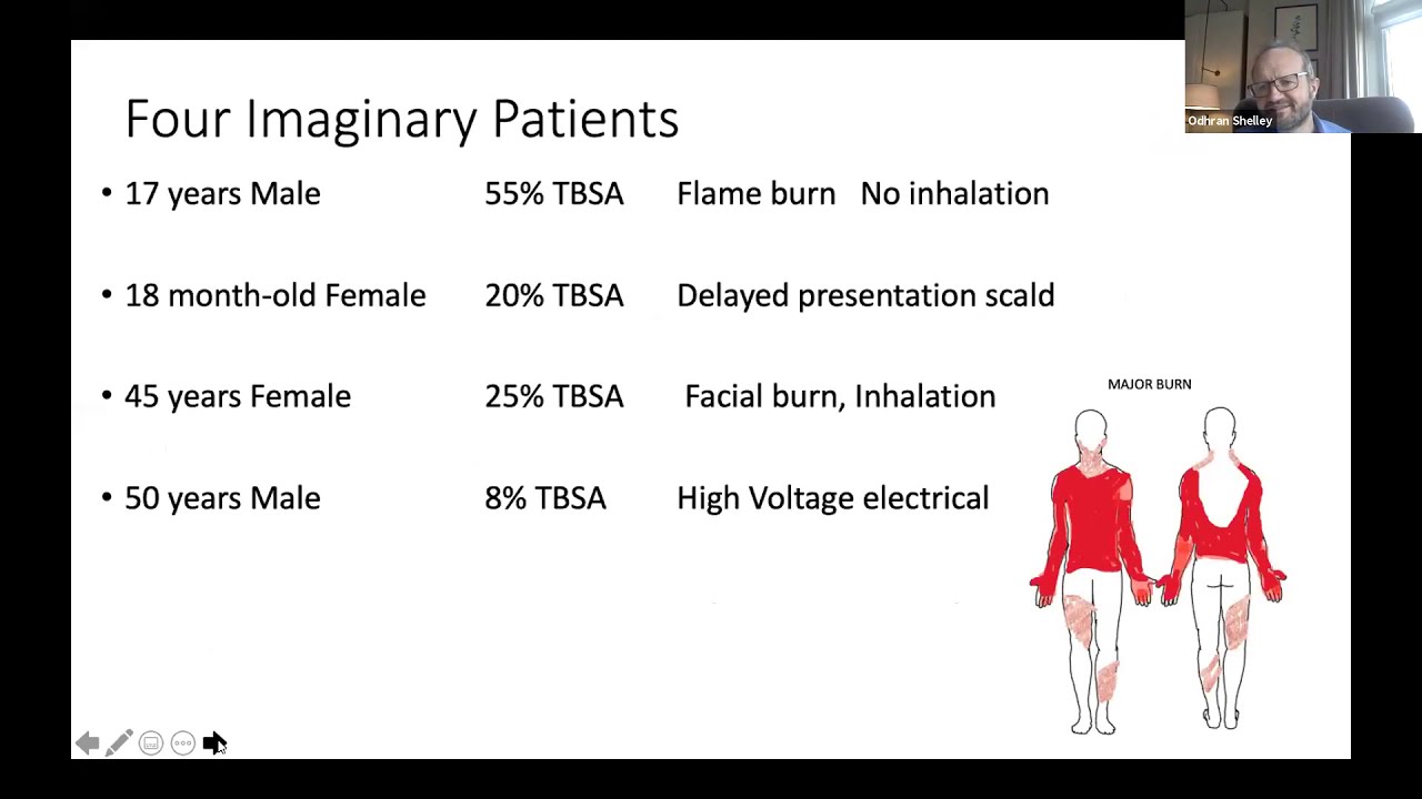 The first week of a patient with a major burn injury - YouTube
