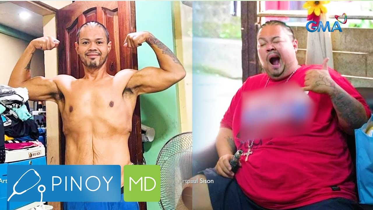 Pinoy MD: Paano magpapayat nang hindi nagkakaroon ng loose skin? - YouTube