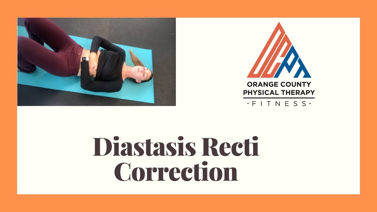 Diastasis Recti Correction Exercise (Orange County Physical Therapy ...