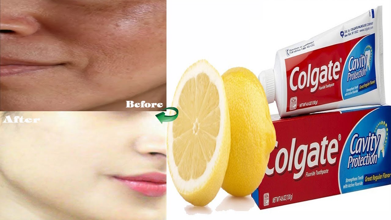 Toothpaste for Skin Whitening | Colgate Toothpaste for Face Whitening ...