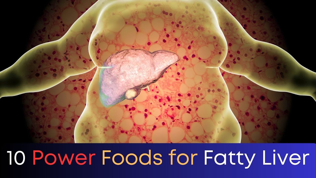Power Foods for Fatty Liver: Nourish Your Liver with These Top Choices ...