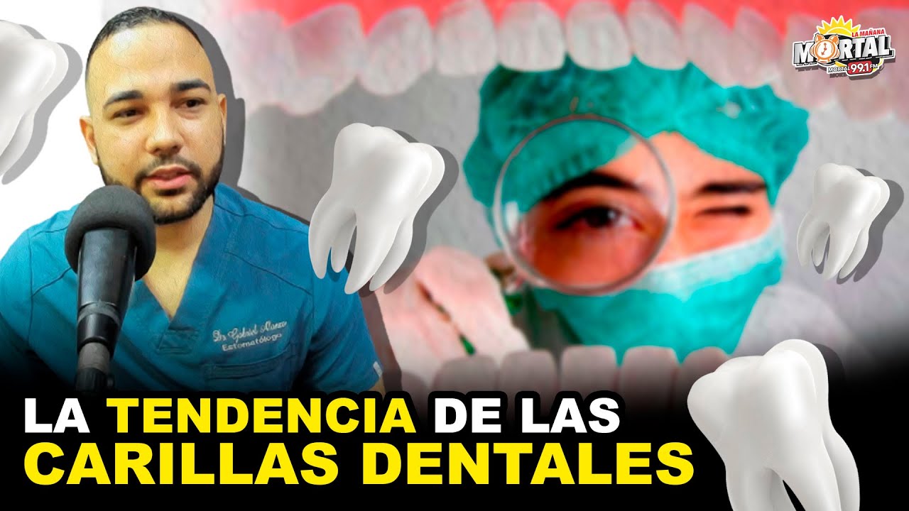 LA TENDENCIA DE LAS CARILLAS DENTALES / DR. GABRIEL ALONZO - YouTube